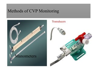 Invasive Blood pressure monitoring presentation | PPT