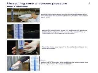 Invasive Blood pressure monitoring presentation | PPTX