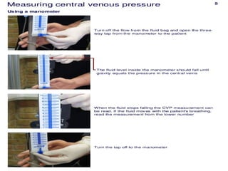 Invasive Blood pressure monitoring presentation | PPTX