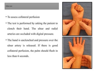 Invasive Blood pressure monitoring presentation | PPTX