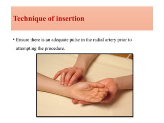 Invasive Blood pressure monitoring presentation | PPTX