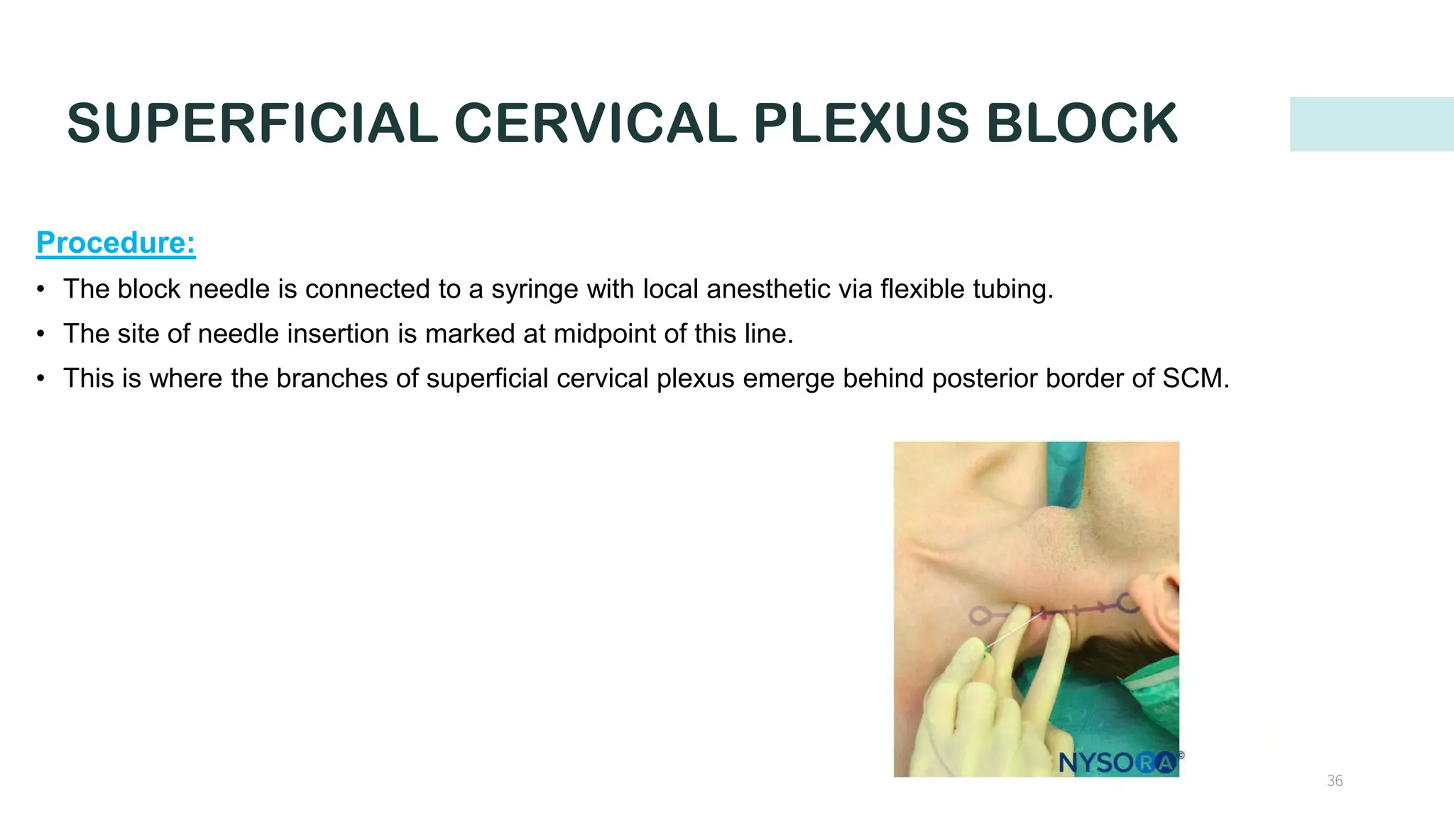 upper limb block and perineural catherers,nerve injury protocol | PDF