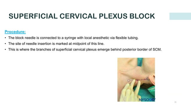upper limb block and perineural catherers,nerve injury protocol | PPT