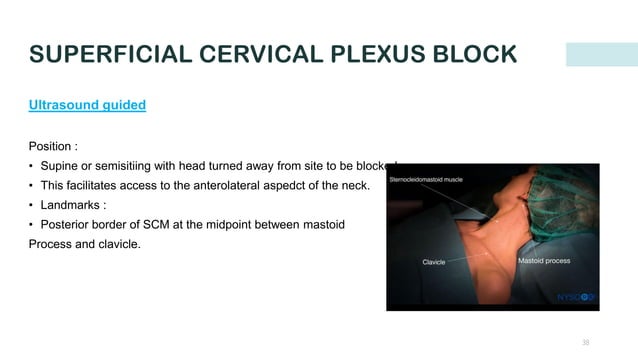 upper limb block and perineural catherers,nerve injury protocol | PPT