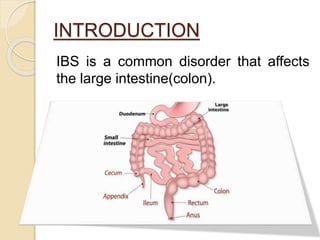 Irritable Bowel Syndrome Diagram