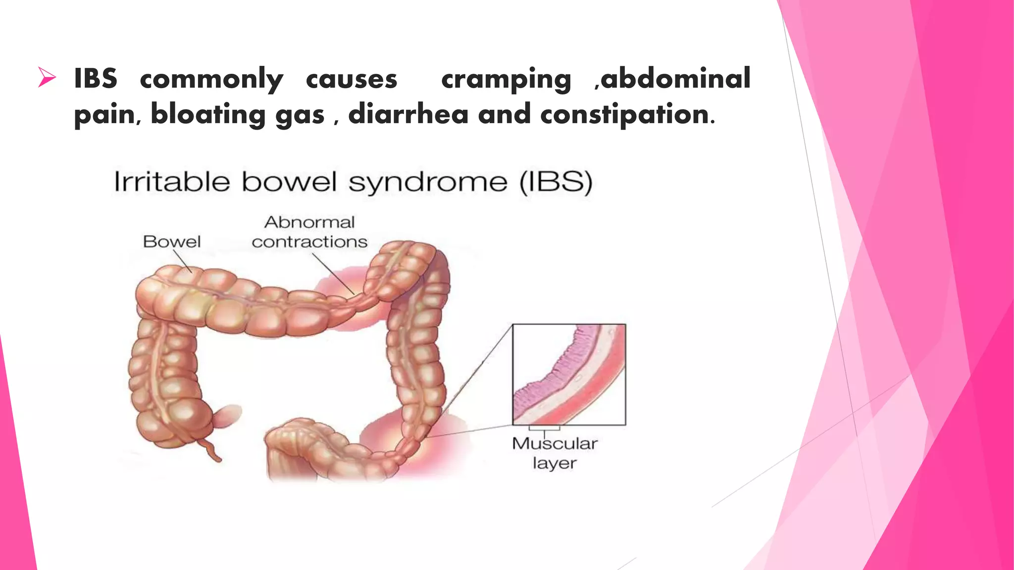 Irritable Bowel Syndrome | PPTX