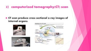 Irritable Bowel Syndrome | PPTX
