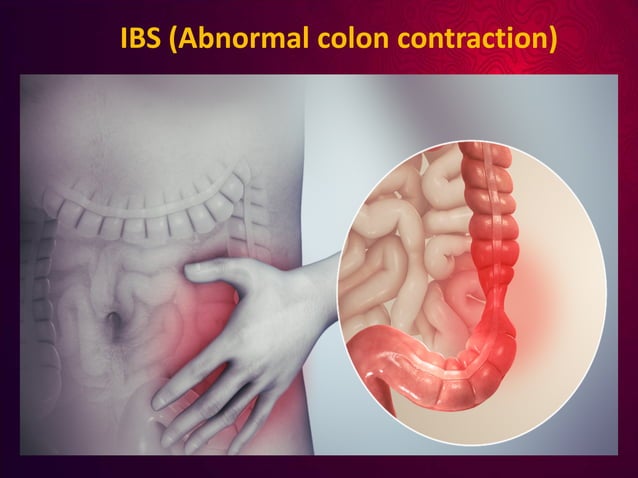 Drugs used in the treatment of irritable bowel syndrome (IBS) | PDF | Digestive Disorders ...