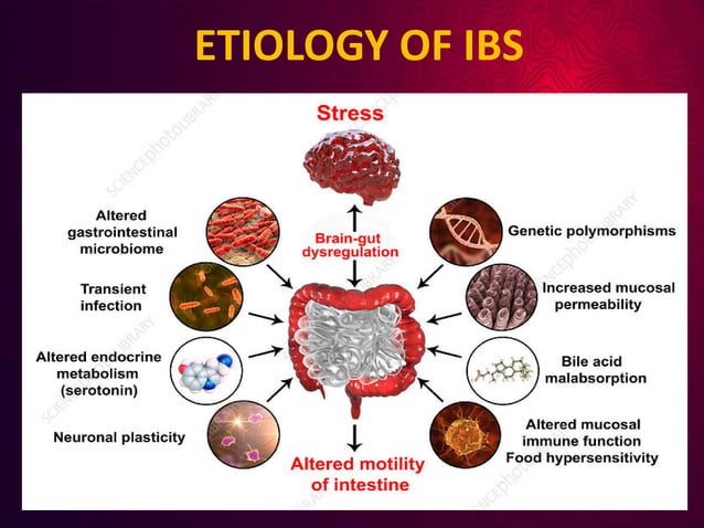 Drugs used in the treatment of irritable bowel syndrome (IBS)