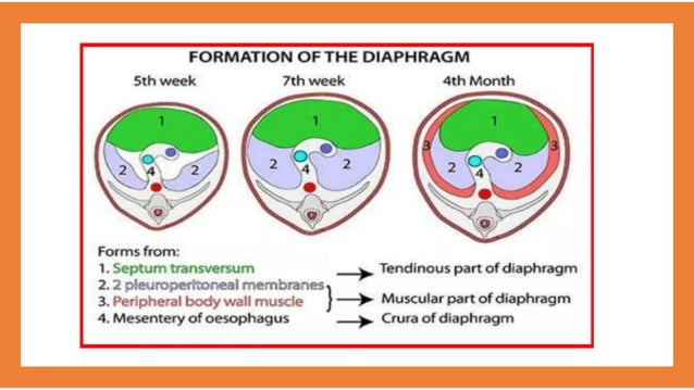 ic- congenital diaphragmatic hernia.pptx