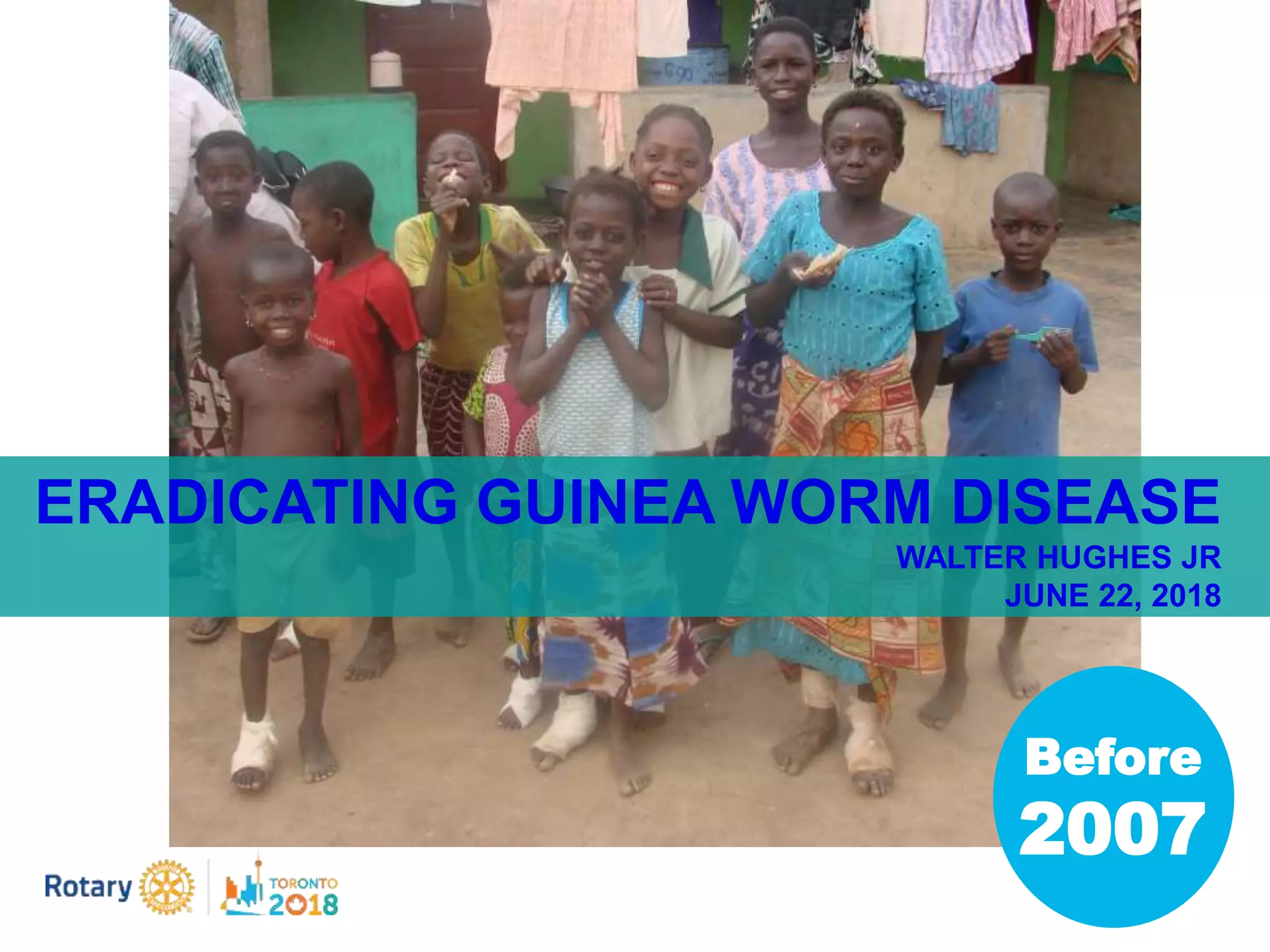 Rotary's role in Eradicating Guinea worm disease | PPTX | Infectious ...