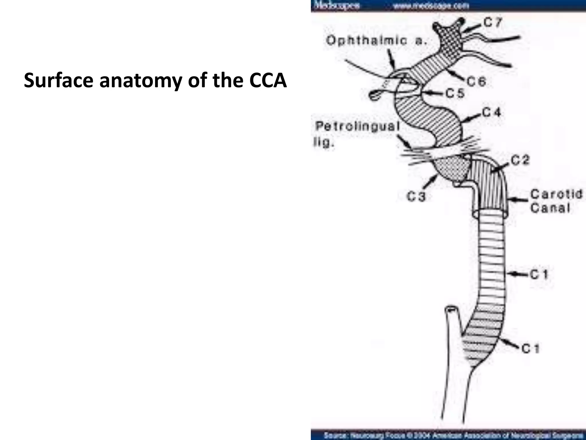 ICA anatomy | PPTX