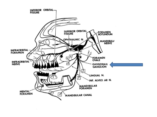 ICA anatomy | PPT