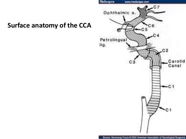 ICA anatomy