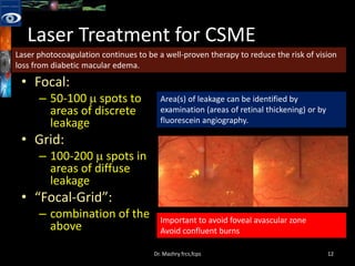 Choosing amongst current modalities to manage diabetic retinopathy ...