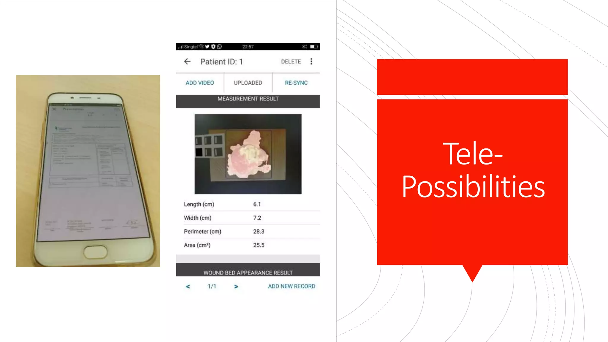 Platform & Standards of Smart Elderly Care At Home | PPT | Free Download