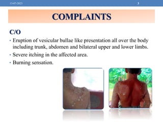 Management of Pemphigus vulgaris A Rare case study By DR AJITH KUMAR | PPT
