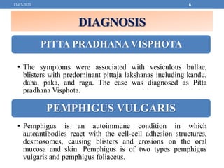 Management of Pemphigus vulgaris A Rare case study By DR AJITH KUMAR | PPT