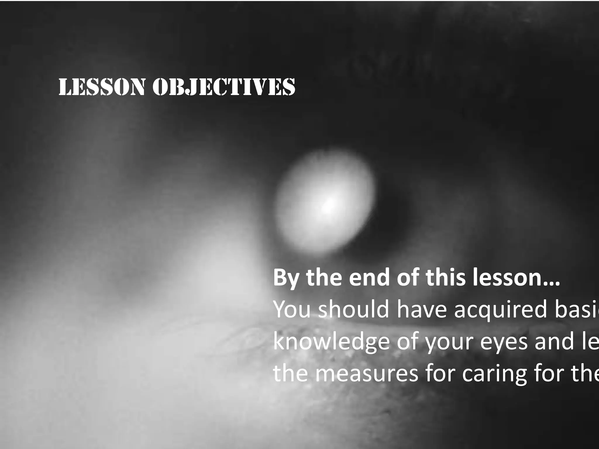 I care eyecare intro | PPT