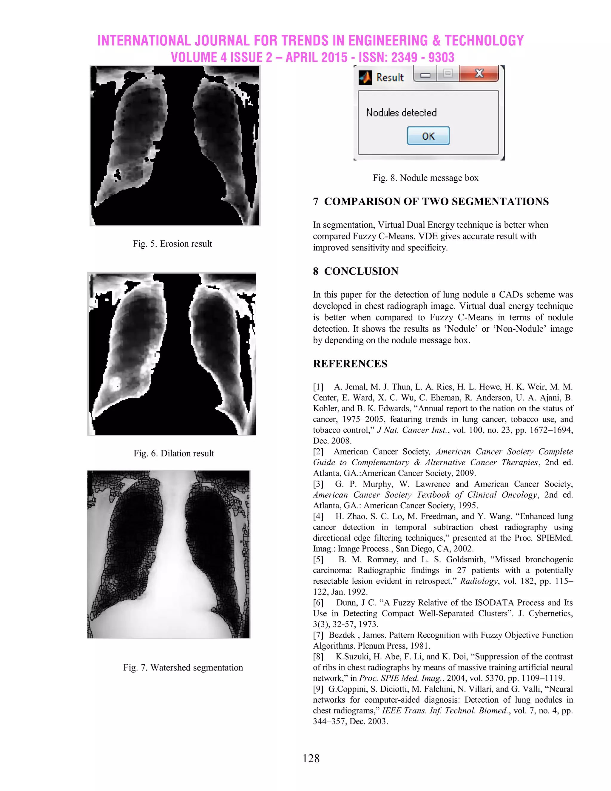 Segmentation and Classification of Lung Nodule in Chest Radiograph Image | PDF