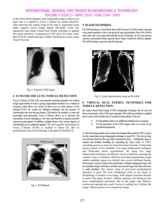 Segmentation and Classification of Lung Nodule in Chest Radiograph Image | PDF