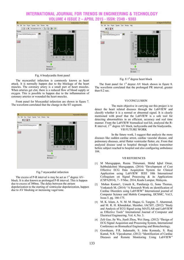 An Efficient System Of Electrocardiogram Data Acquisition And Analysis ...