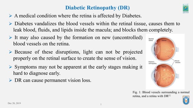 A presentation on "Early Blindness Detection Based on Retinal Images ...