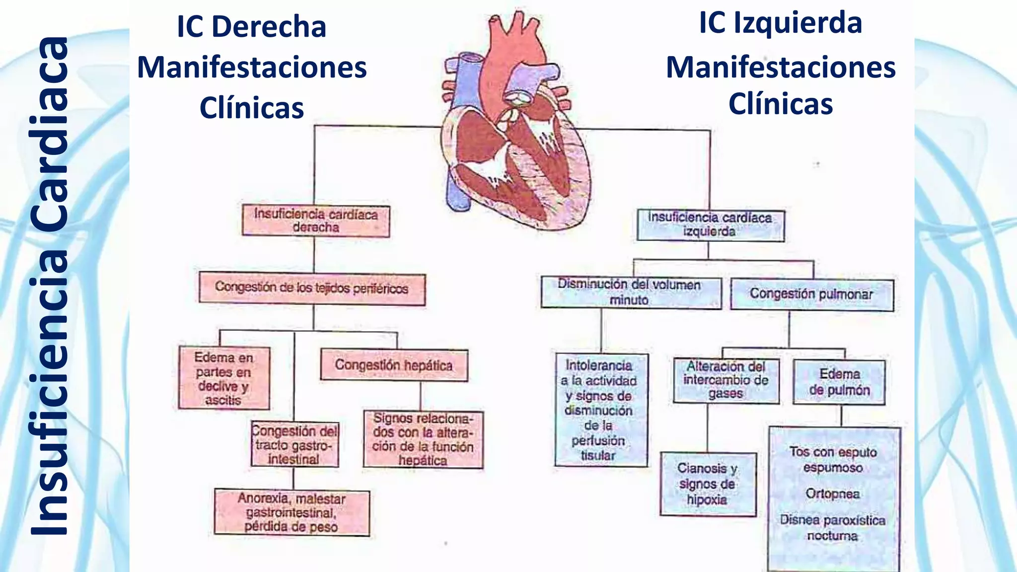 Insuficiencia Cardíaca y Edema Pulmonar Agudo | PPTX