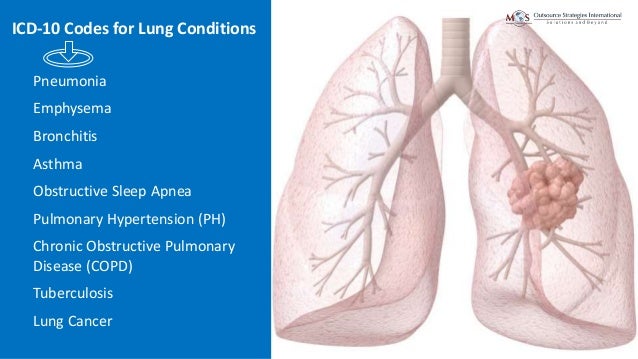 ICD-10 Codes for Common Lung Conditions | PPSX