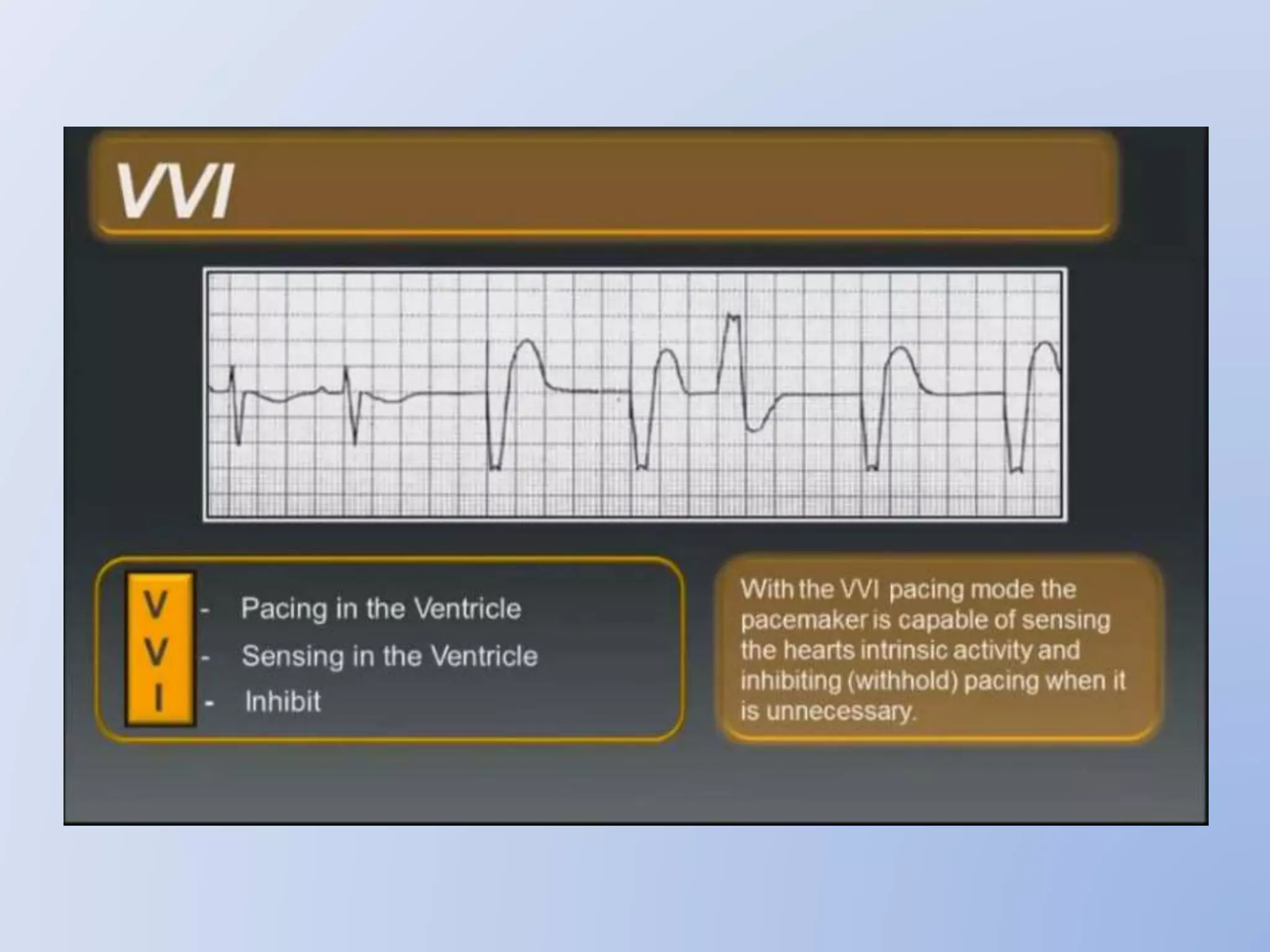 Implantable Cardiac Devices | PPTX