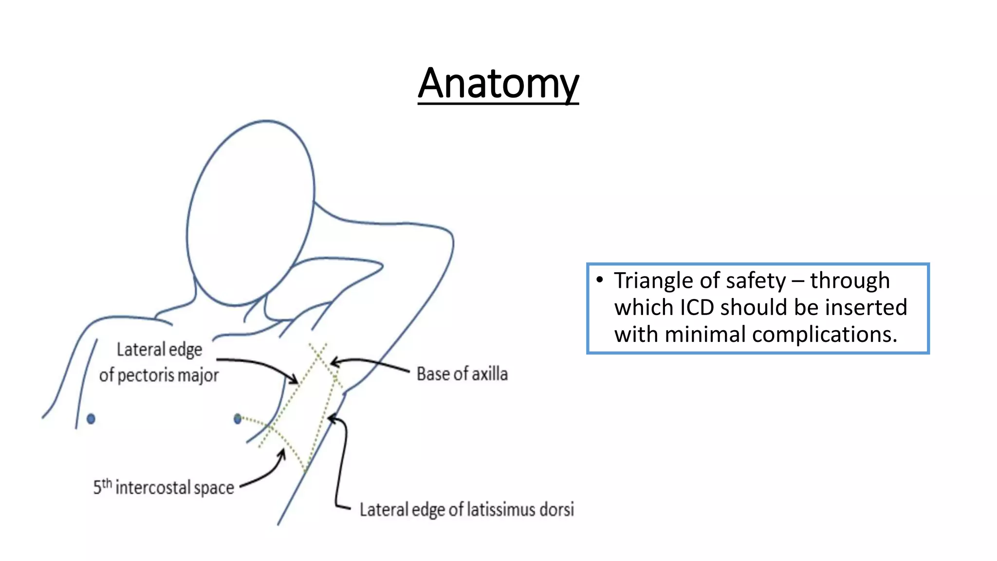 Intercostal Drainage Tube | PPTX