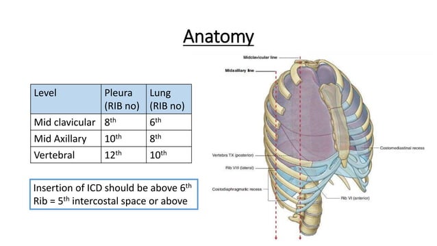 Intercostal Drainage Tube | PPTX