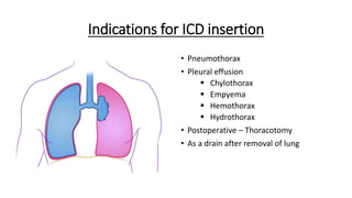 Intercostal Drainage Tube | PPT