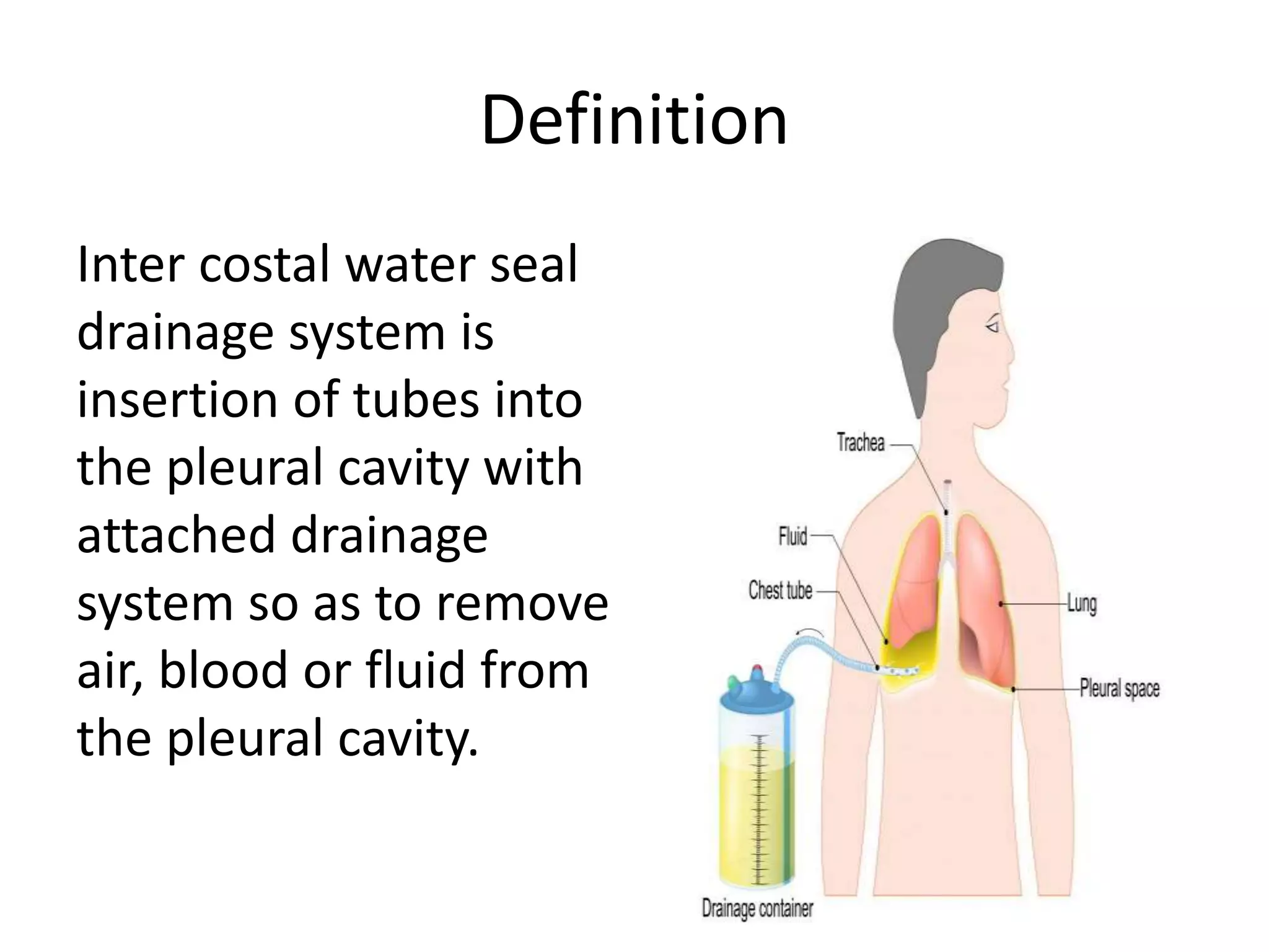 Intercostal drainage tube insertion | PPTX