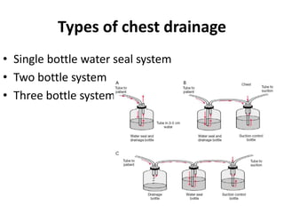 Intercostal drainage tube insertion | PPTX