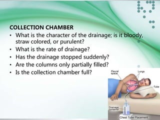 CHEST TUBE DRAINAGE | PPTX
