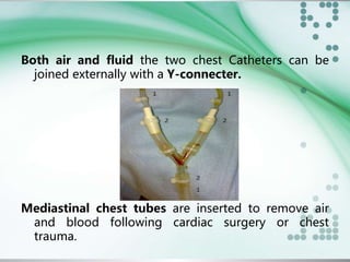 CHEST TUBE DRAINAGE | PPT