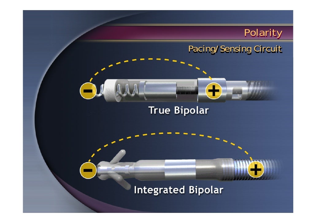 Basic ICD treatment_lecture