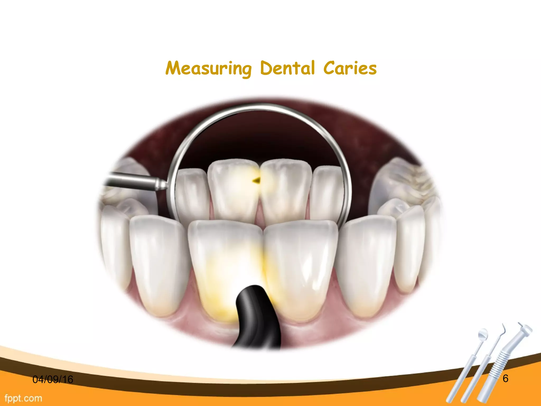 International Caries Detection and Assessment System (ICDAS) | PPT