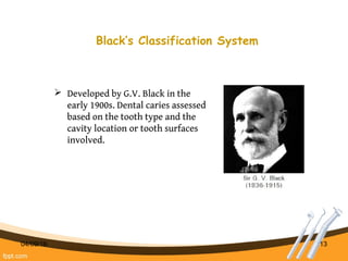 International Caries Detection and Assessment System (ICDAS) | PPT