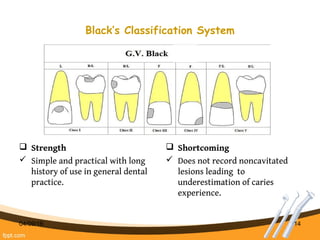 International Caries Detection and Assessment System (ICDAS) | PPT