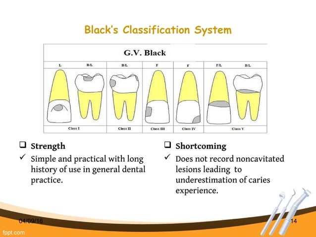 International Caries Detection and Assessment System (ICDAS) | PPT