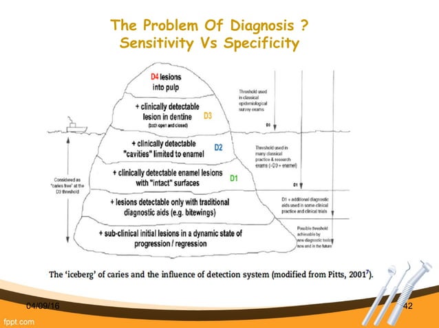 International Caries Detection and Assessment System (ICDAS) | PPT