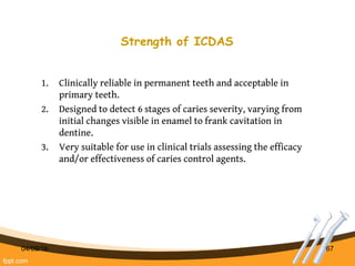International Caries Detection and Assessment System (ICDAS) | PPT