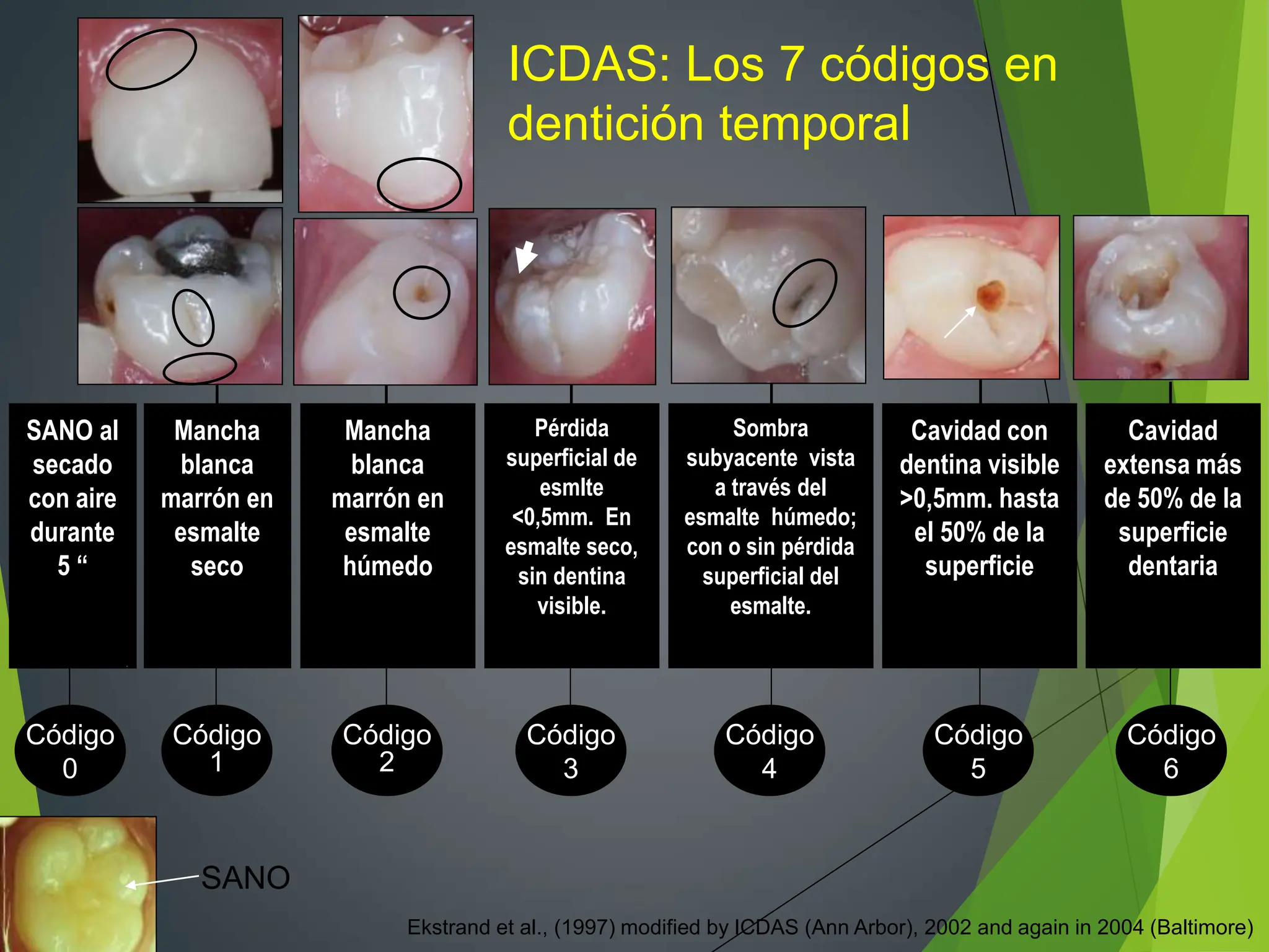 CRITERIOS ICDAS PARA DETECTAR CARIES DE ESMALTE Y DENTINA | PPT