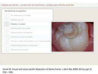 ICDAS -sistema internacional de detección y diagnostico de caries | PDF