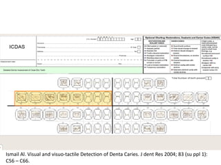 ICDAS -sistema internacional de detección y diagnostico de caries | PDF
