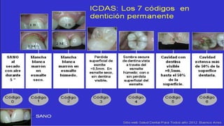 Clasificación Icdas odontología 2024.pptx