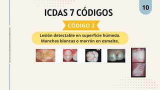 criterios ICDAS, cariologia, avance de las caries .pdf