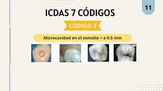 criterios ICDAS, cariologia, avance de las caries .pdf